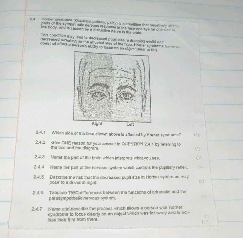 2.4 Horner syndrome (Oculosympathetic palsy) | StudyX