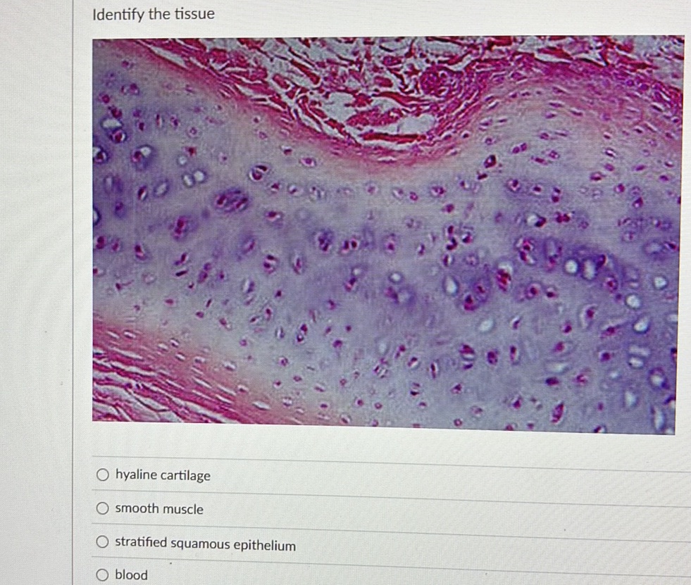 Identify the tissue * hyaline cartilage * | StudyX