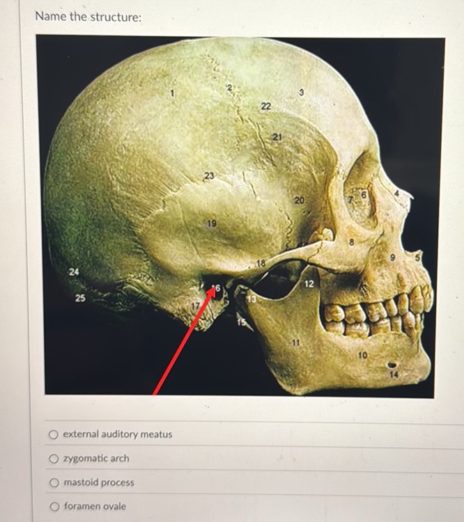 Name the structure: * external auditory | StudyX