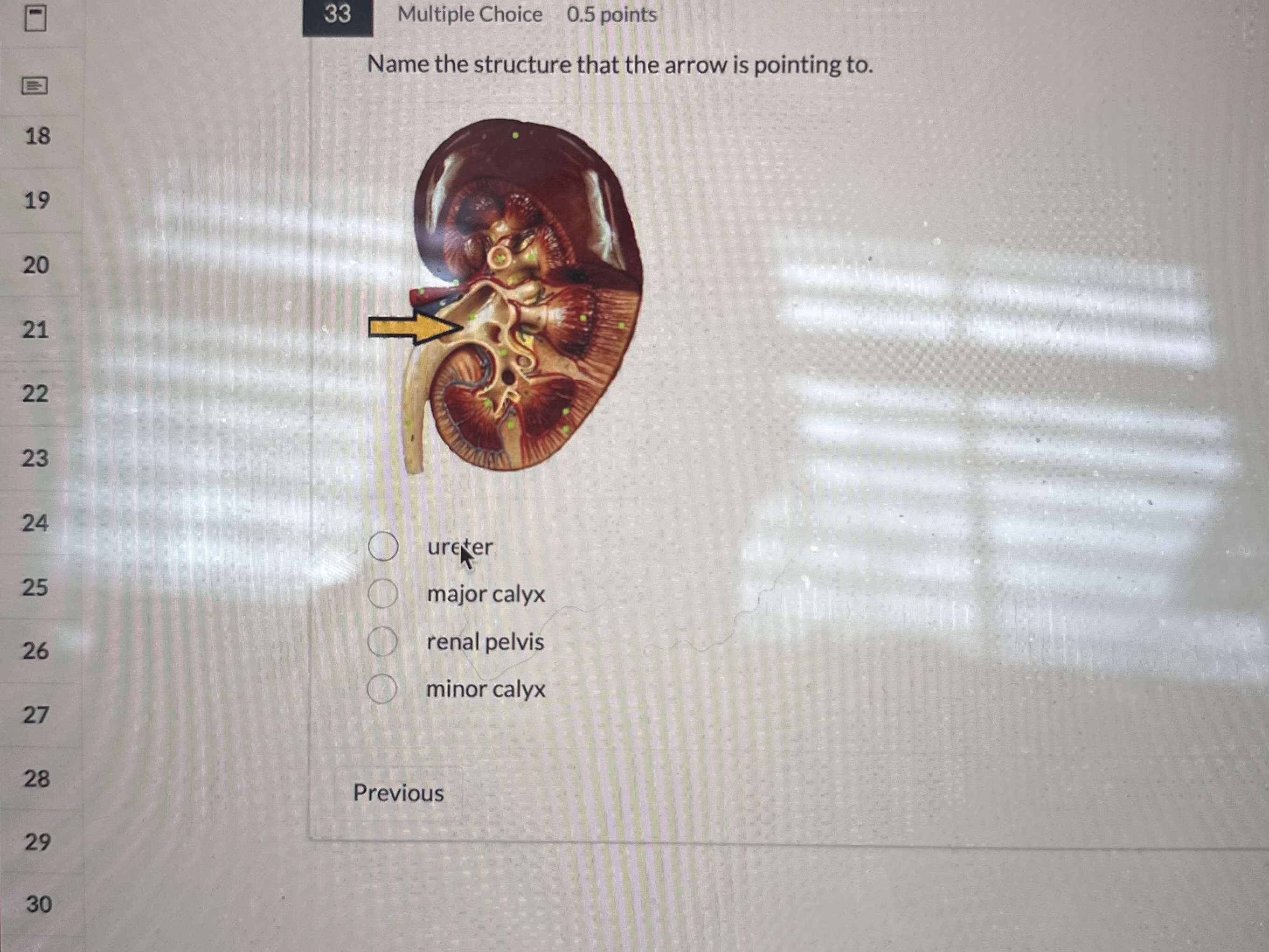 Name the structure that the arrow is | StudyX