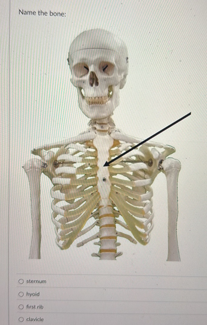 Name the bone: * sternum * hyoid * | StudyX