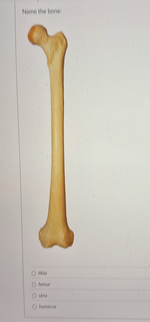 Name the bone: * tibia * femur * ulna | StudyX