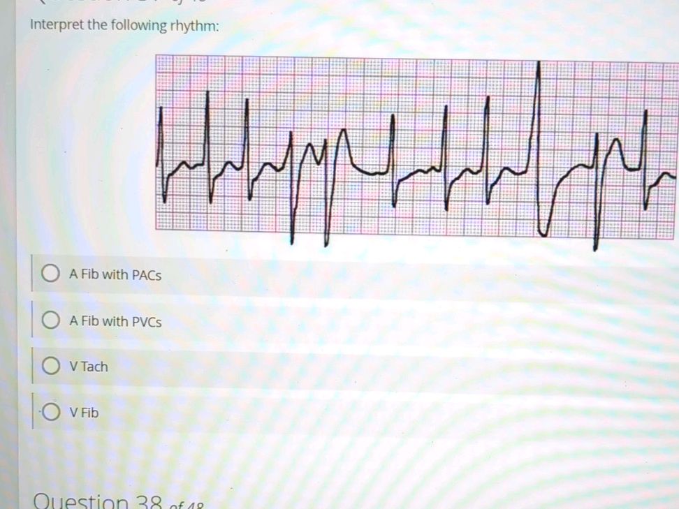 Interpret the following rhythm: A Fib with | StudyX