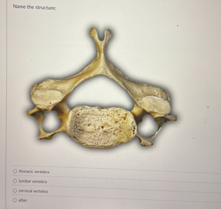 Name the structure: thoracic vertebra | StudyX