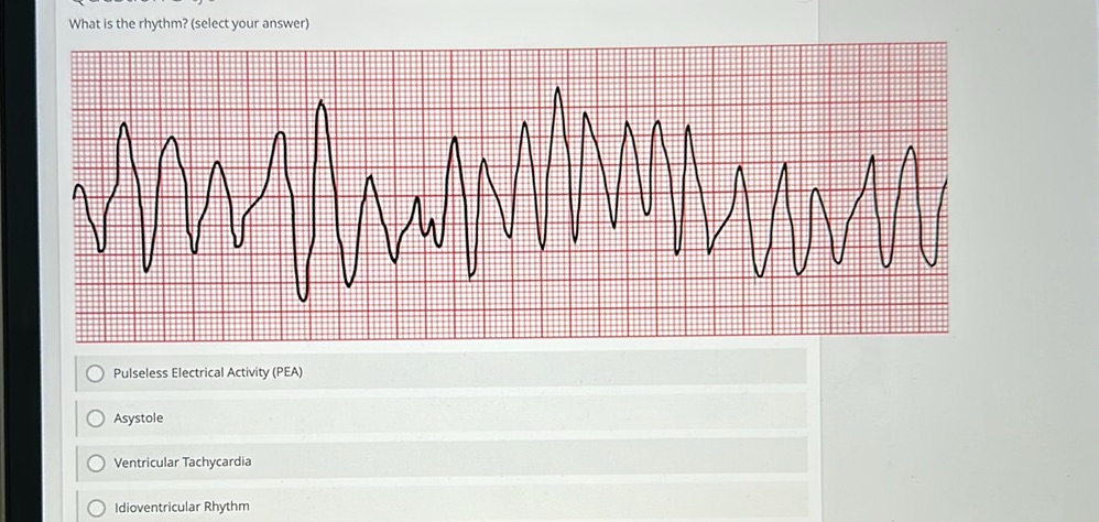What is the rhythm? (select your answer) | StudyX