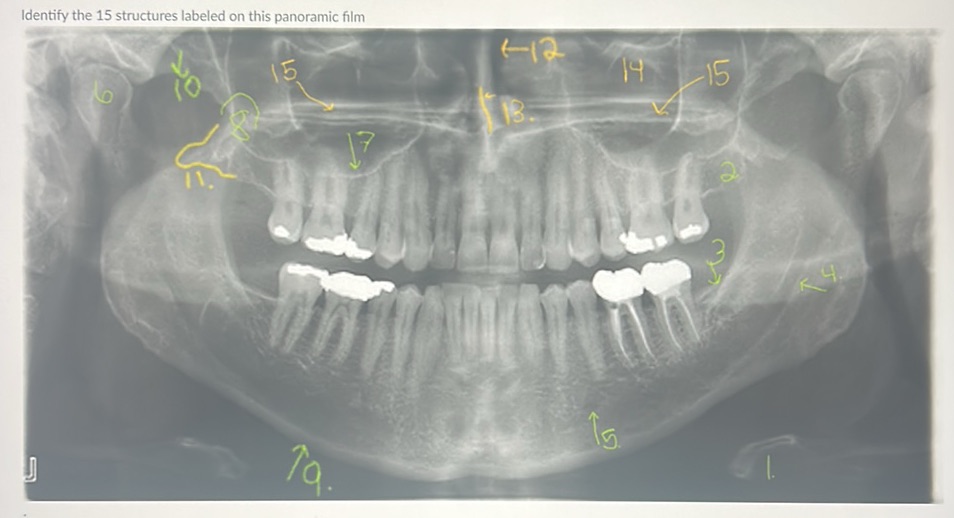 Identify the 15 structures labeled on this | StudyX