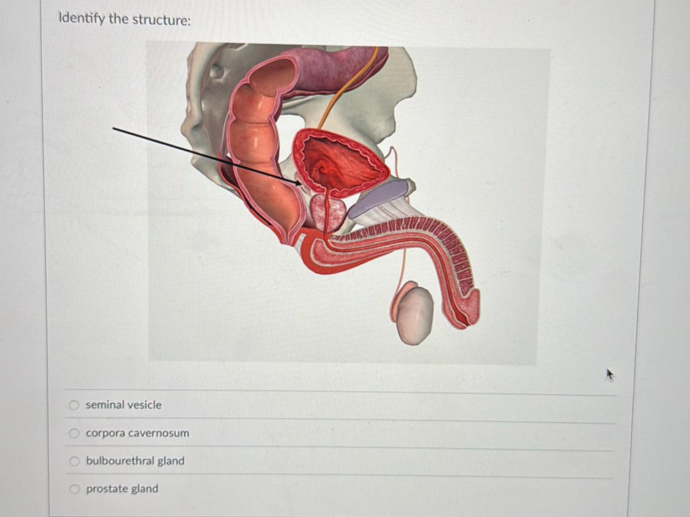 Identify the structure: * seminal vesicle | StudyX