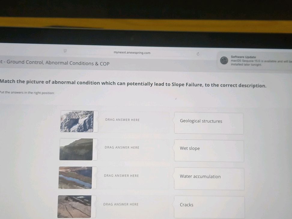 Match the picture of abnormal condition | StudyX