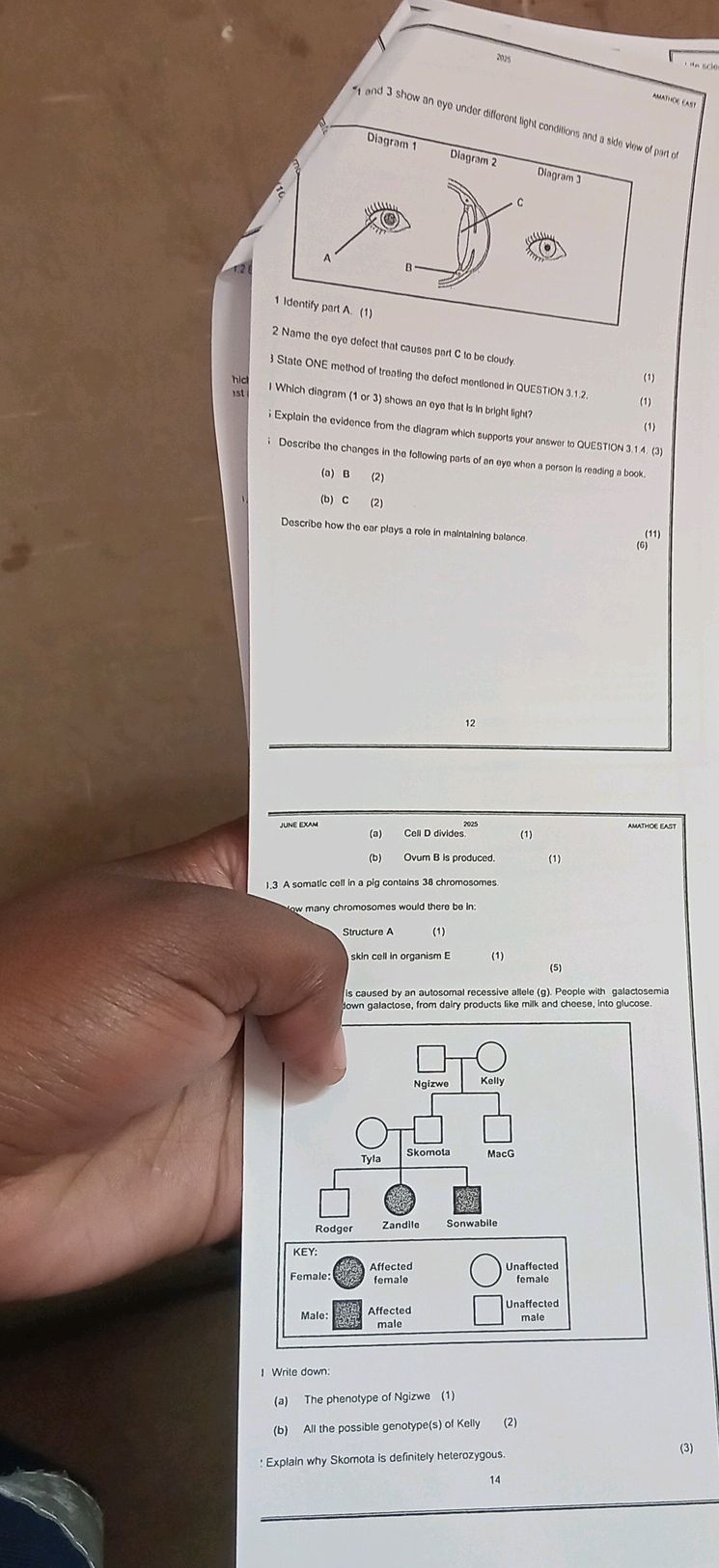 1 Identify part A. (1) 2 Name the eye defect | StudyX
