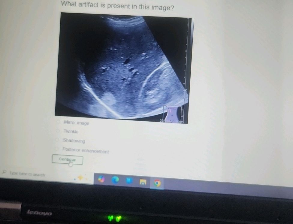 What artifact is present in this image? | StudyX