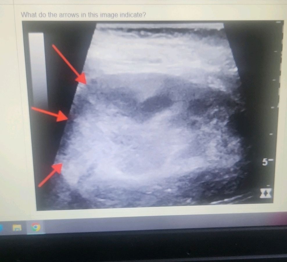 What do the arrows in this image indicate? | StudyX