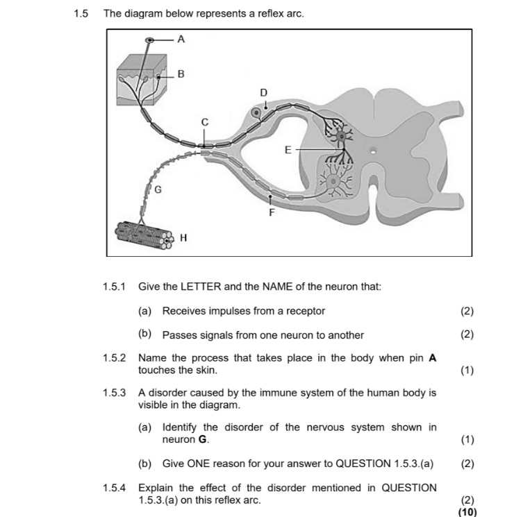 1.5 The diagram below represents a reflex | StudyX