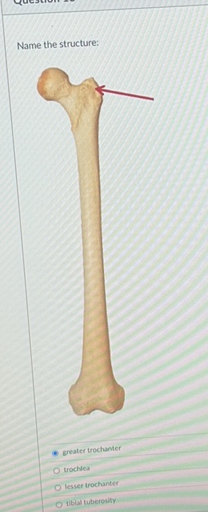 Name the structure: * greater trochanter | StudyX