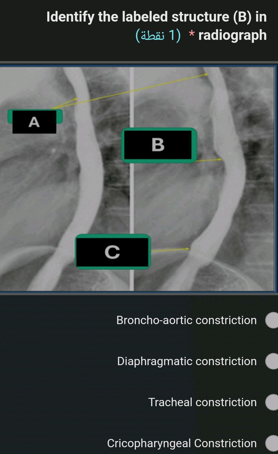 Identify the labeled structure (B) in | StudyX