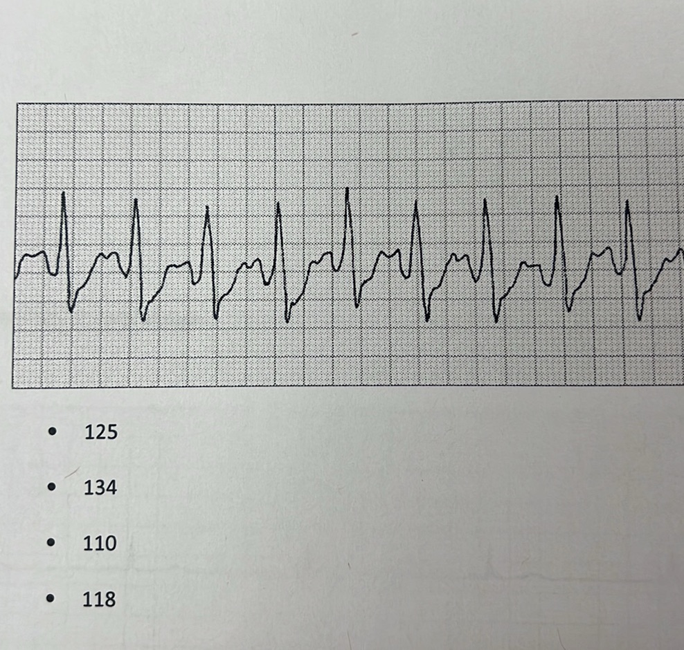 The image shows an ECG tracing. * 125 * | StudyX