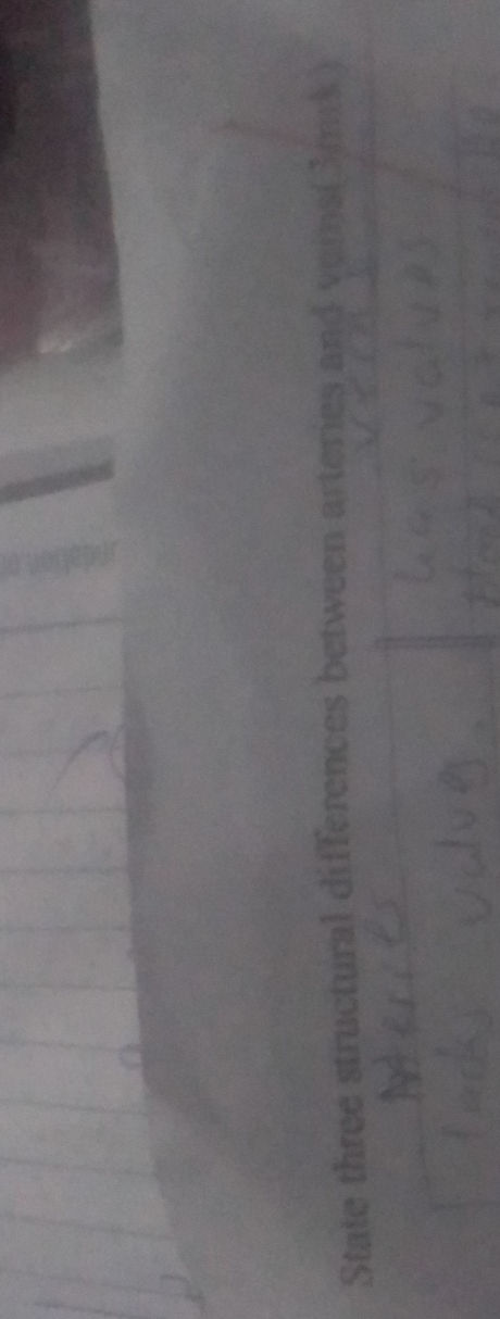 State three structural differences between | StudyX