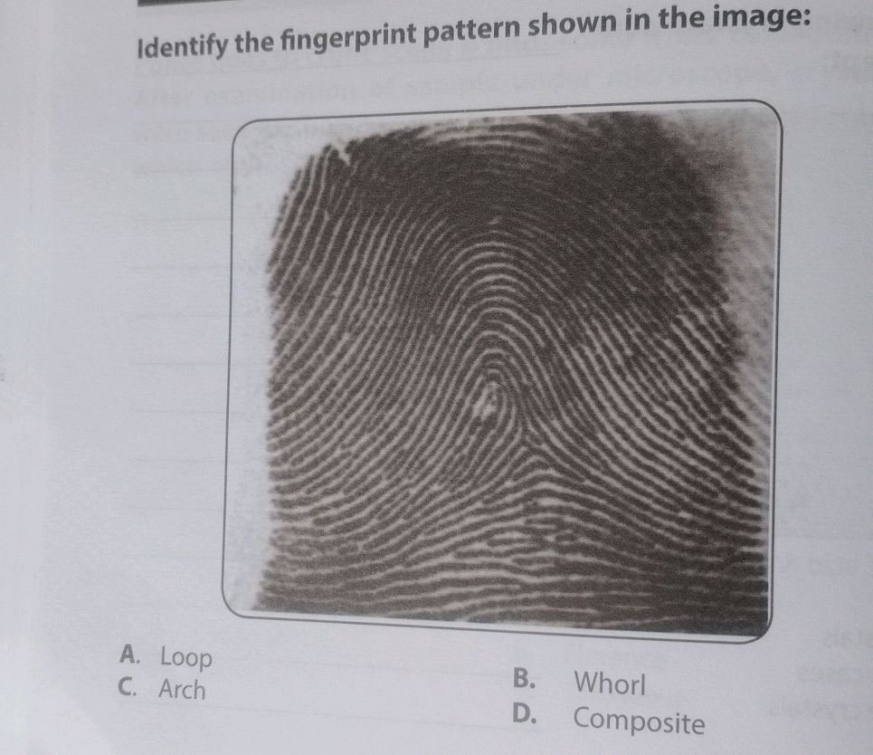 Identify the fingerprint pattern shown in | StudyX