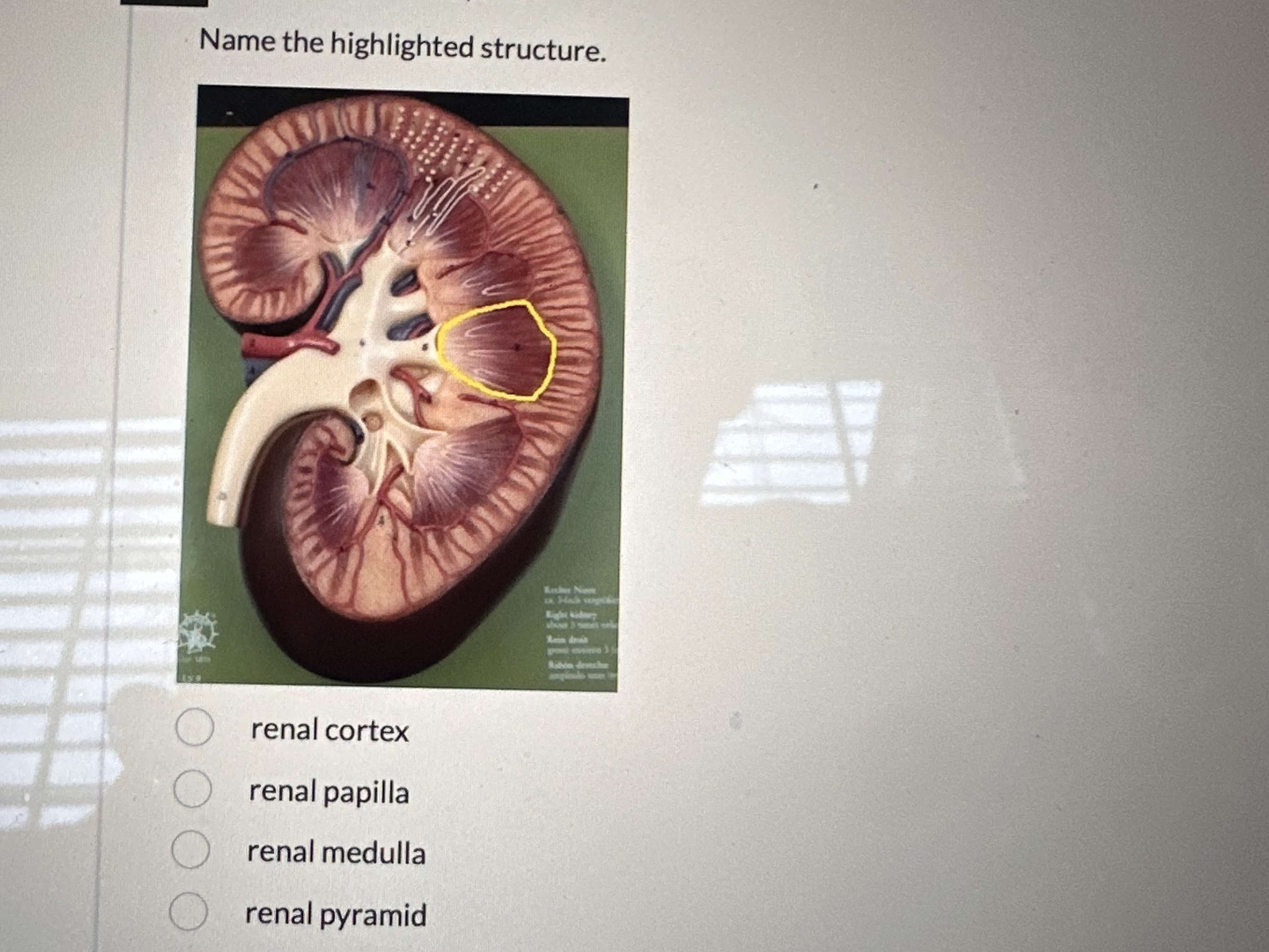 Name the highlighted structure. renal | StudyX