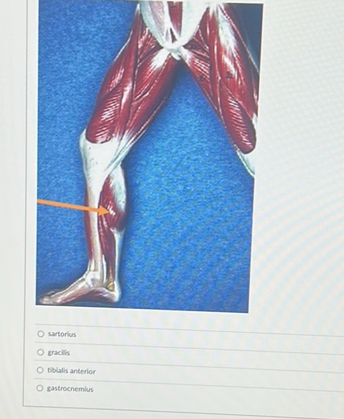 Which muscle is indicated by the arrow? | StudyX