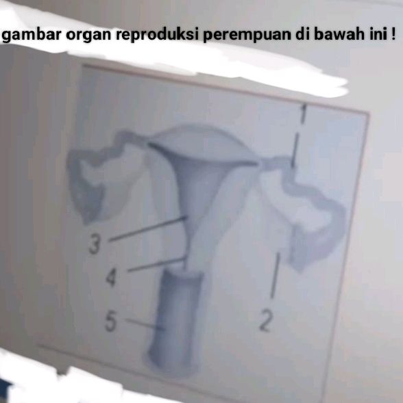 gambar organ reproduksi perempuan di bawah | StudyX
