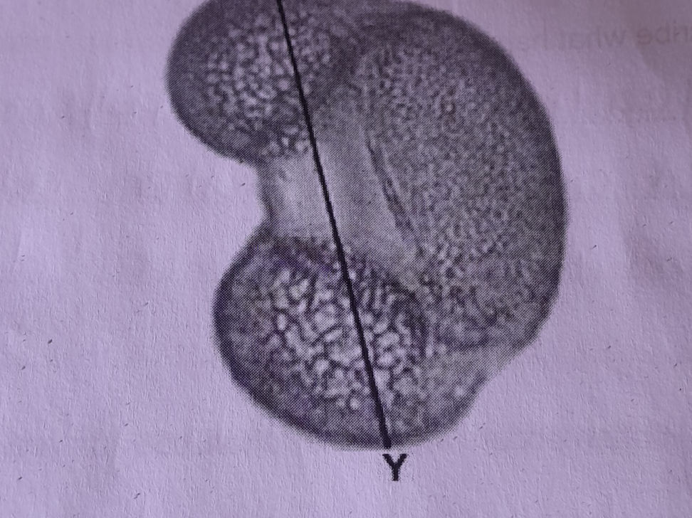 The image shows a diagram of a biological | StudyX