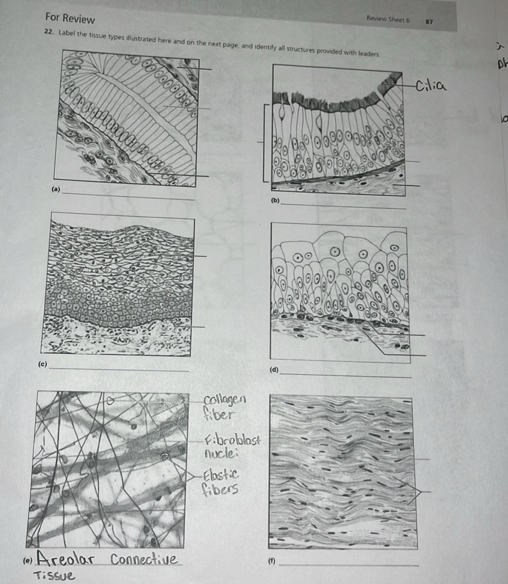 22. Label the tissue types illustrated here | StudyX