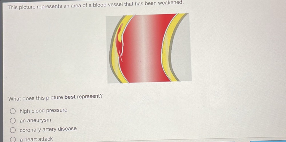 This picture represents an area of a blood | StudyX
