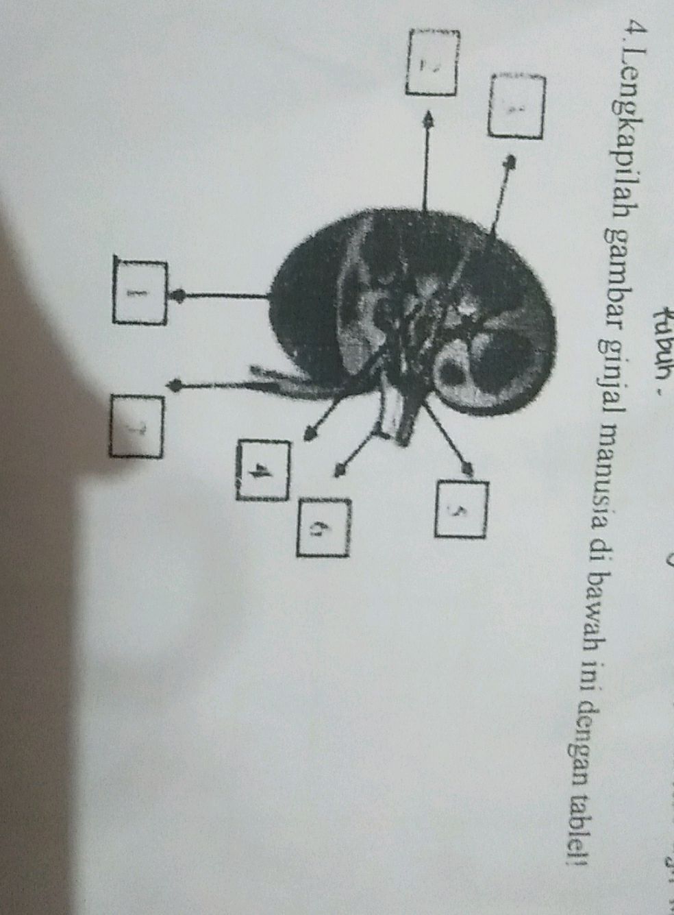 4. Lengkapilah gambar ginjal manusia di | StudyX