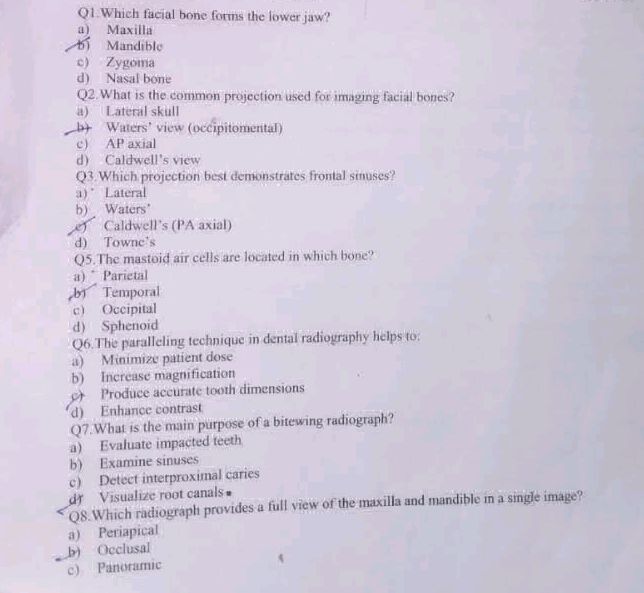 Q1. Which facial bone forms the lower jaw? | StudyX