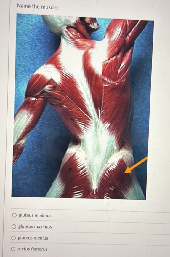 Name the muscle: * gluteus minimus * | StudyX