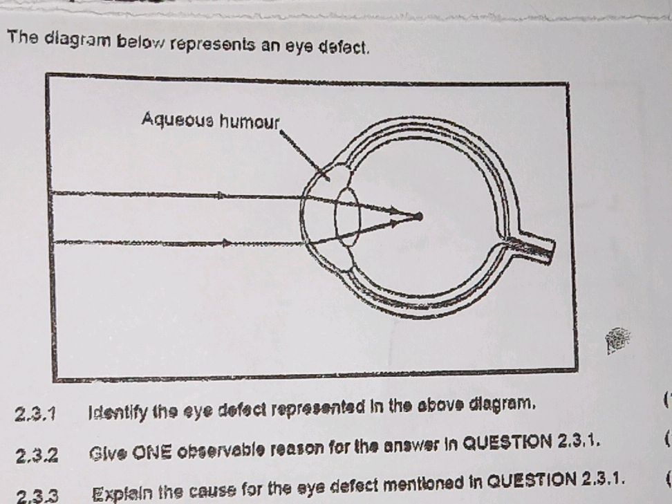 The diagram below represents an eye defect. | StudyX