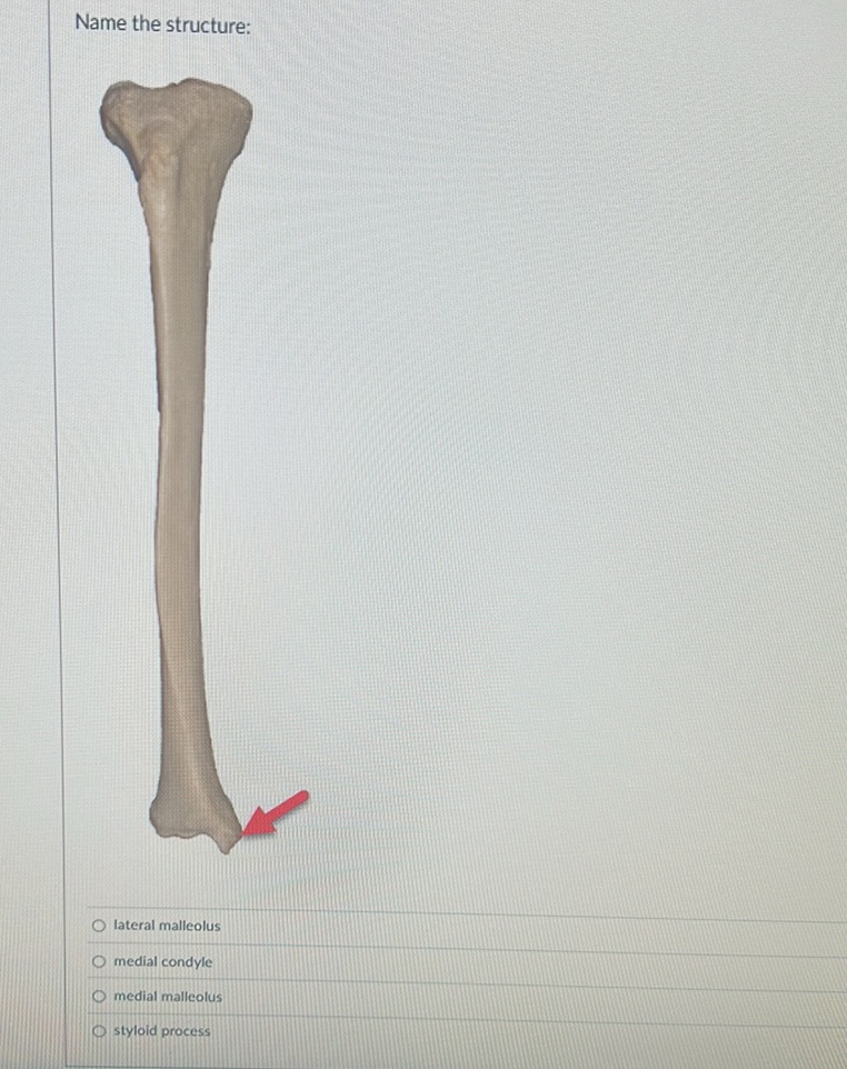 Name the structure: * lateral malleolus * | StudyX