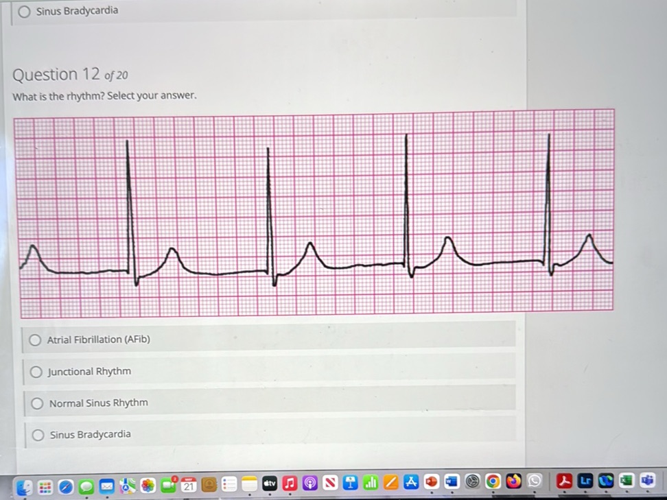 Question 12 of 20 What is the rhythm? Select | StudyX
