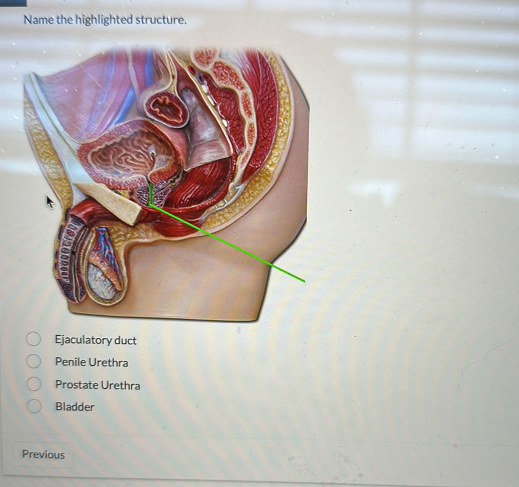 Name the highlighted structure. * | StudyX