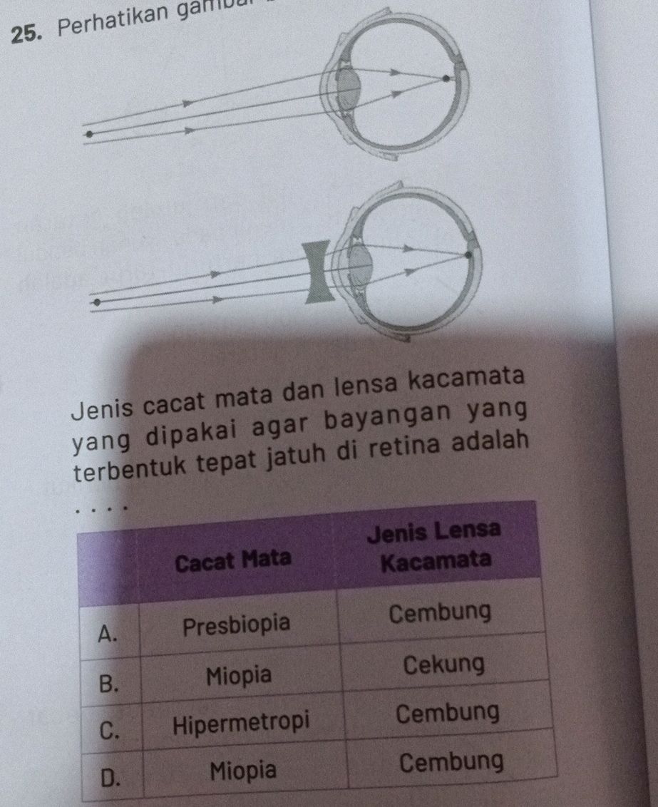 Perhatikan gambar. Jenis cacat mata dan | StudyX