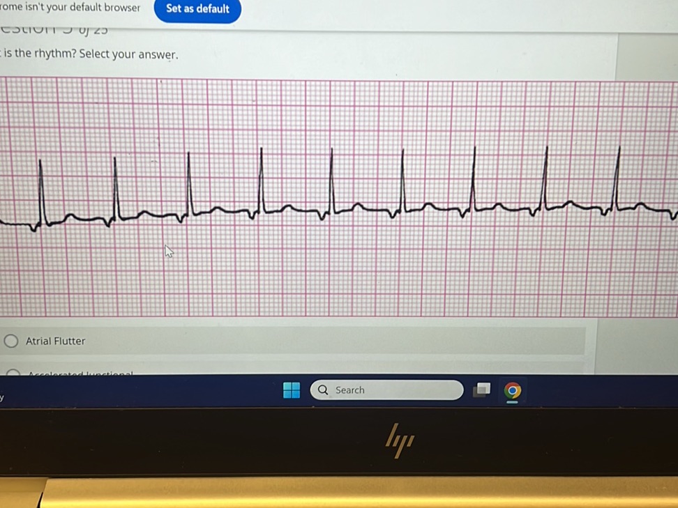 What is the rhythm? Select your answer. | StudyX