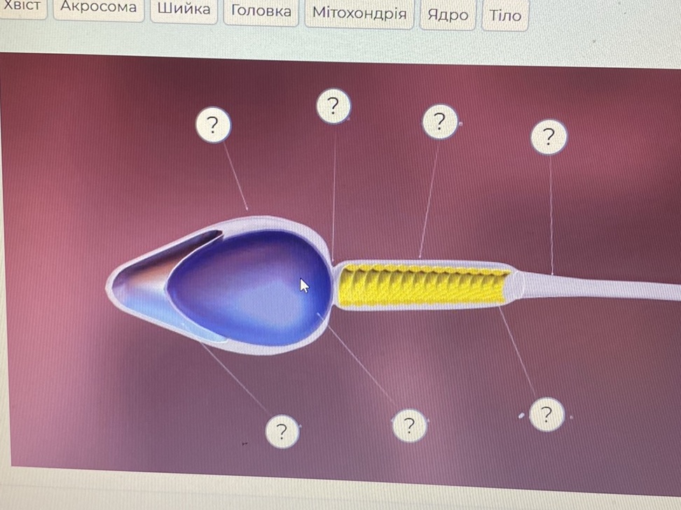 The image shows a diagram of a sperm cell | StudyX