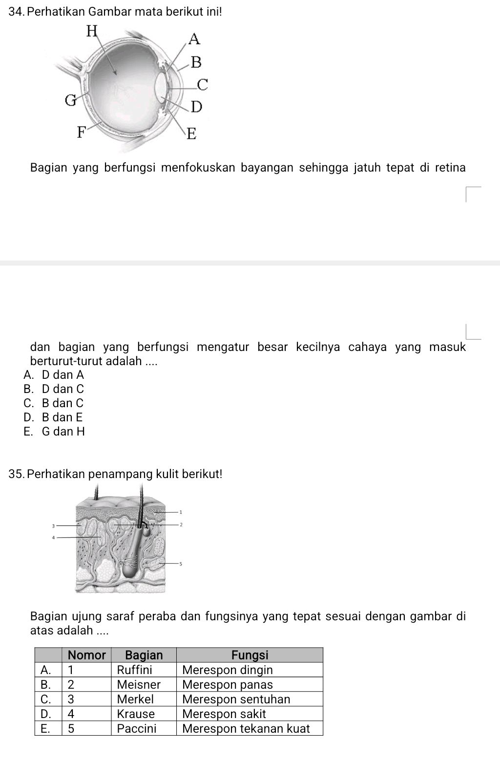 34. Perhatikan Gambar mata berikut ini! | StudyX