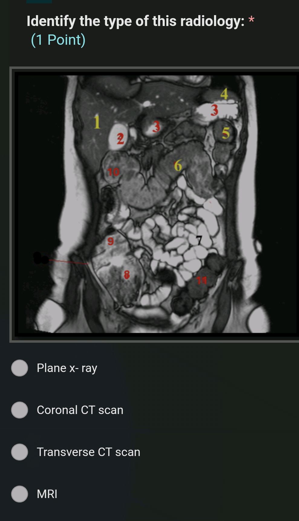 Identify the type of this radiology: * (1 | StudyX