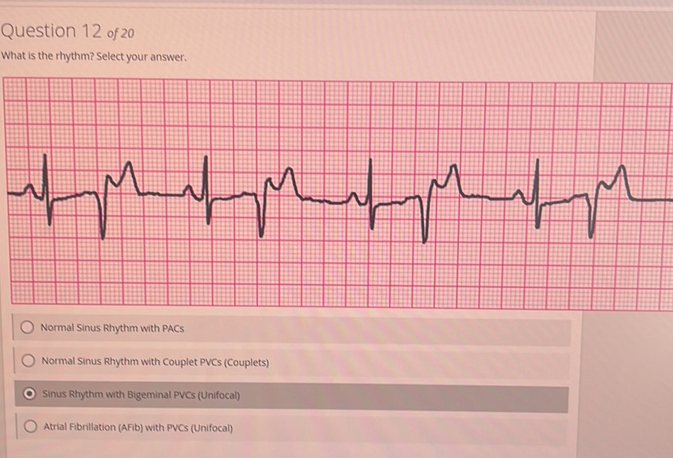 Question 12 of 20 What is the rhythm? Select | StudyX