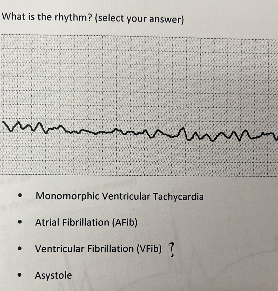 What is the rhythm? (select your answer) * | StudyX